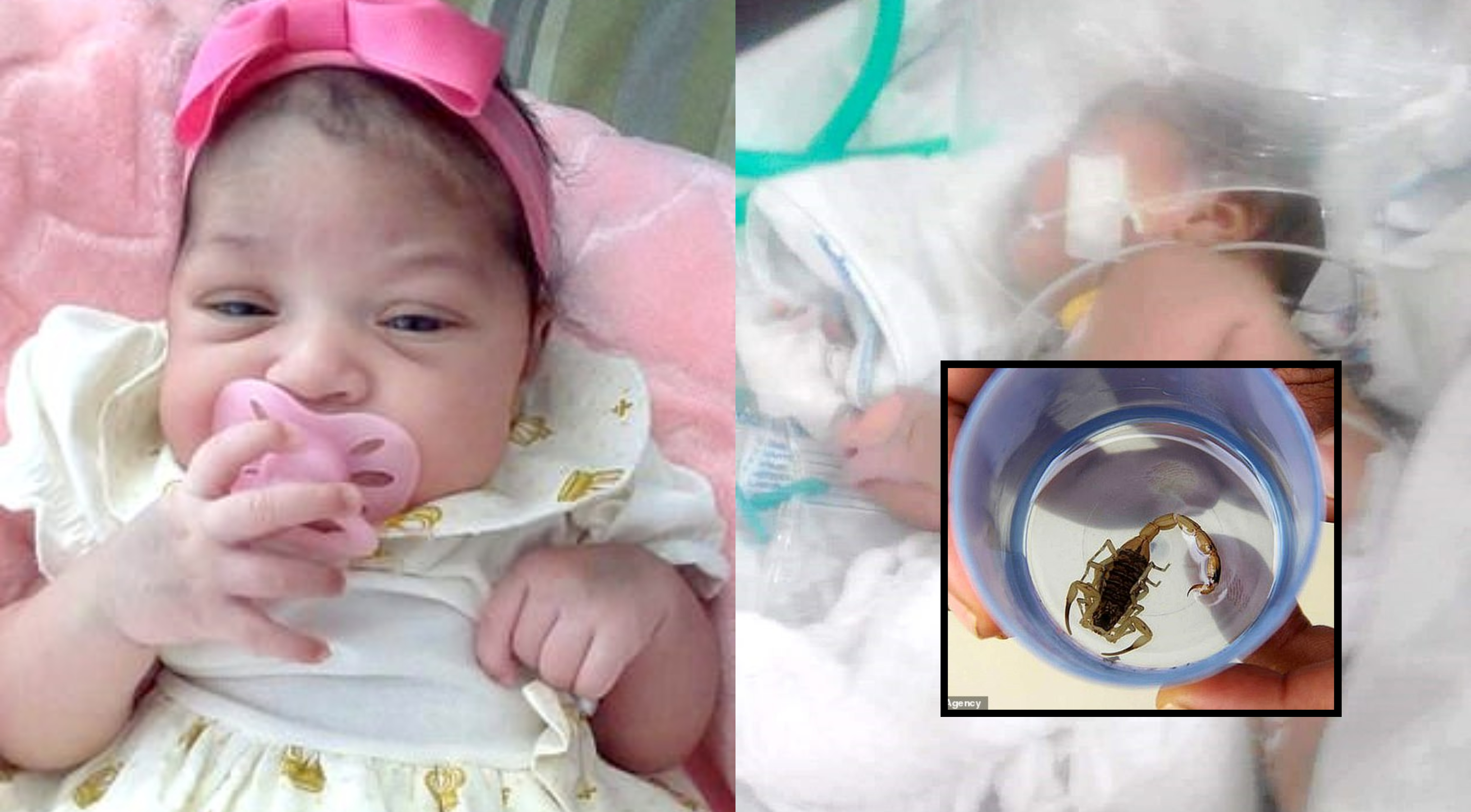 Bayi Umur 3 Hari Hampir Maut, Kala Jengking Dijumpai Dalam Lampin ...