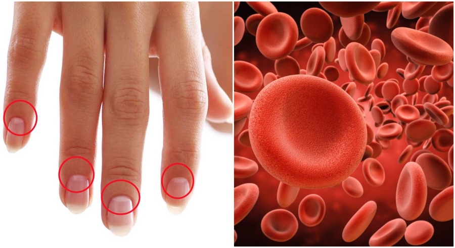 Pentingnya Kewujudan 'Bunga Kuku' Di Jari, Ada Kaitan Dengan Kondisi ...