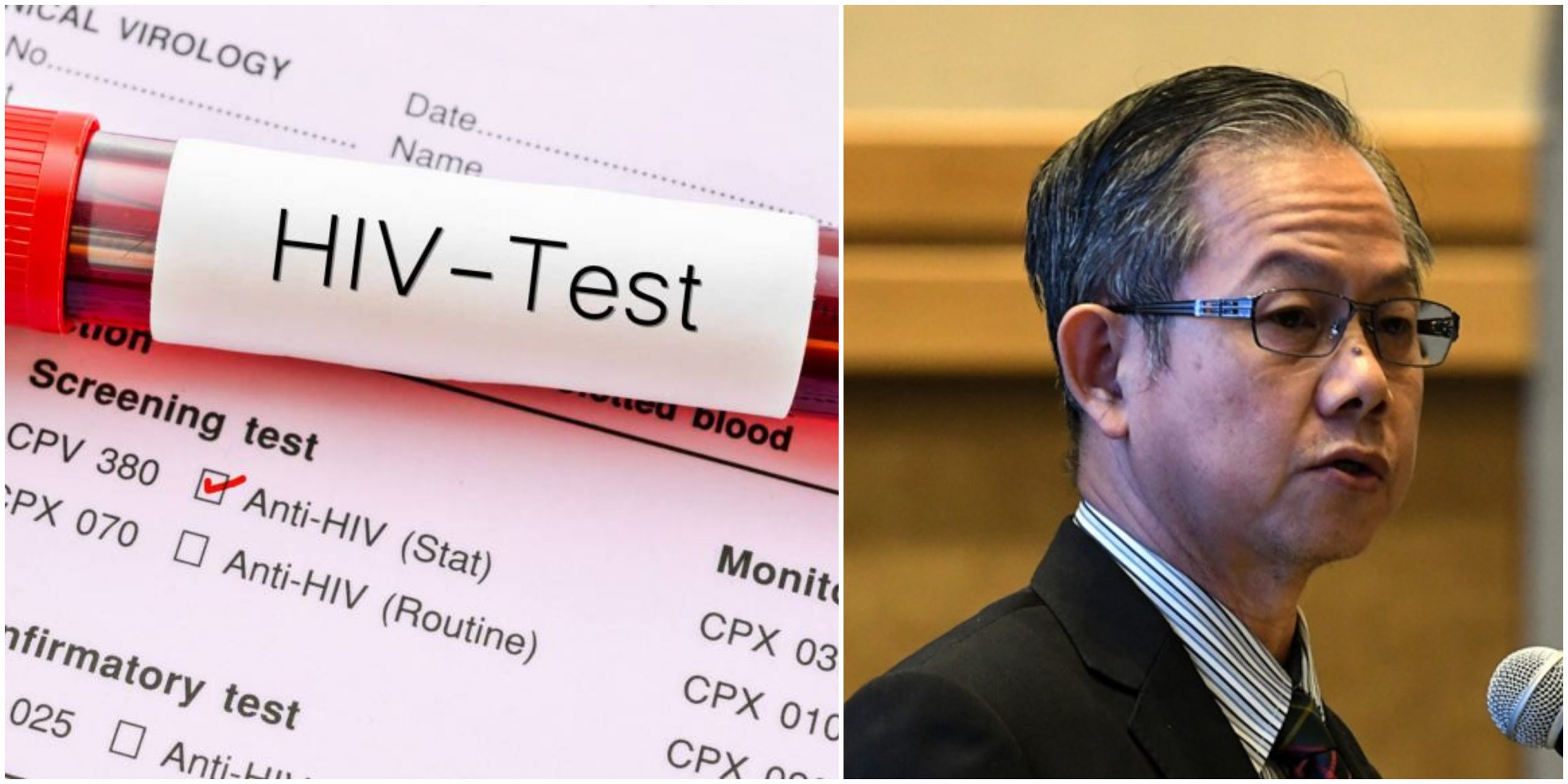 3,293 Kes Jangkitan Virus HIV Dan AIDS Setakat Tahun Lepas