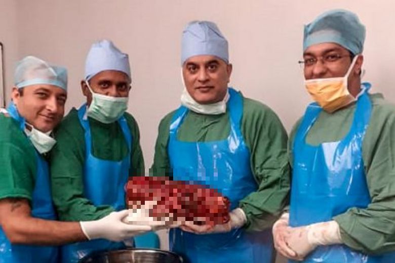 Pakar Bedah Di India Berjaya Keluarkan Buah Pinggang Seberat 7.4 Kg