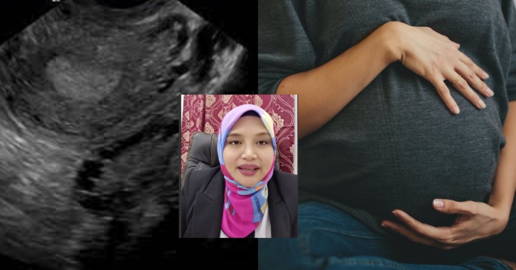 Teringin Anak Tapi Hidap PCOS, Doktor Kongsi 6 Tips Ikhtiar Hamil Secara Semula Jadi Buat Bakal Ibu