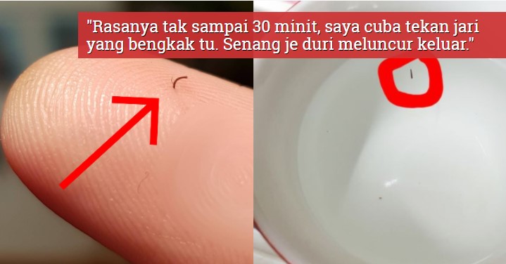 Kalau Jari Terkena Selumbar Atau Duri, Cuba Rendam Dalam Air Bancuhan ...