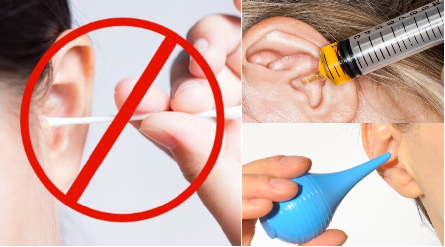 Bahaya Korek Telinga Dengan Putik Kapas, Ini 3 Cara Bersihkan Tahi ...