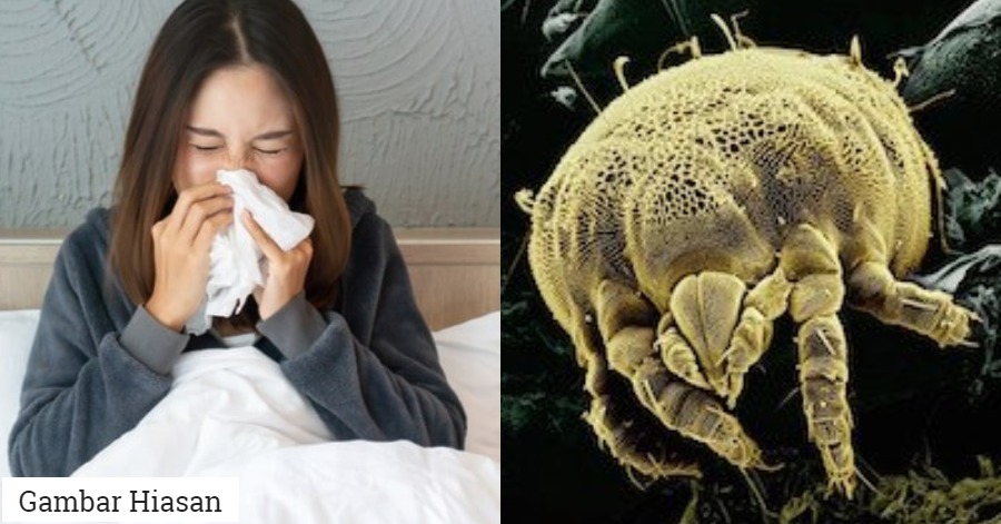 Bilik Bersih Pun Masih Batuk, Selsema Dan Kulit Gatal-gatal? Ini Cara ...