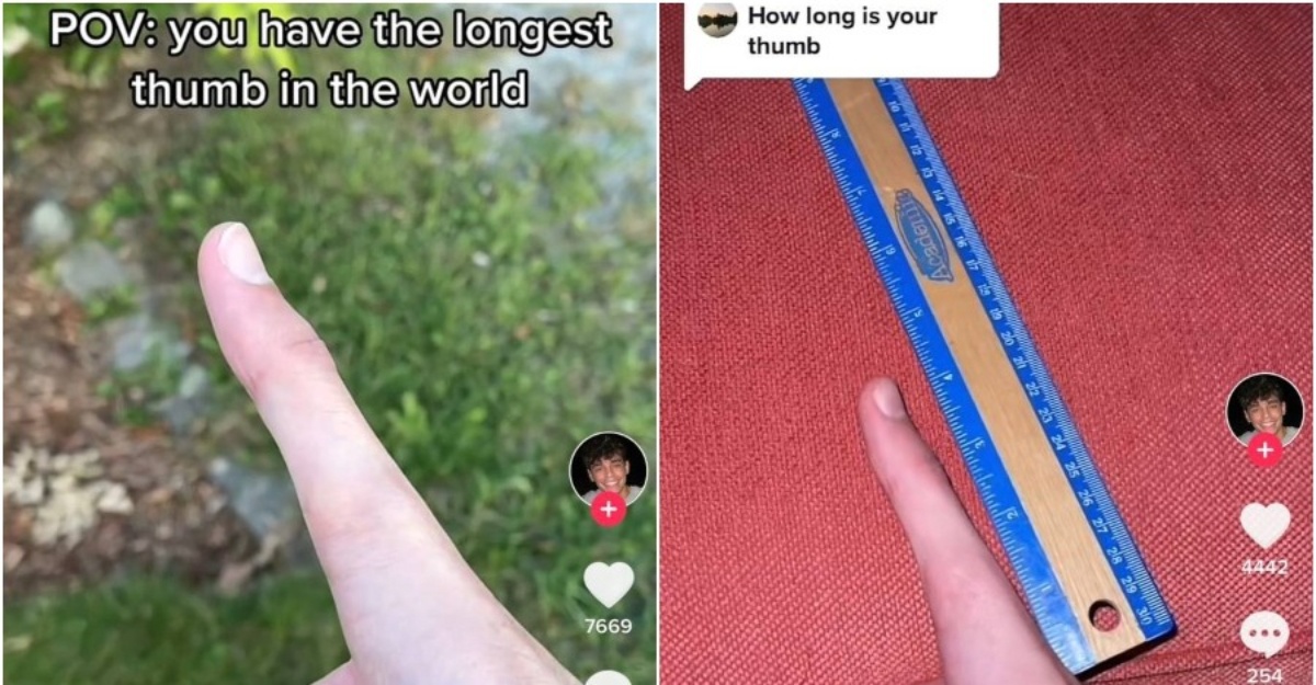 Boleh Panjangkan Sampai 5 Inci, Remaja Dakwa Miliki Ibu Jari Terpanjang ...