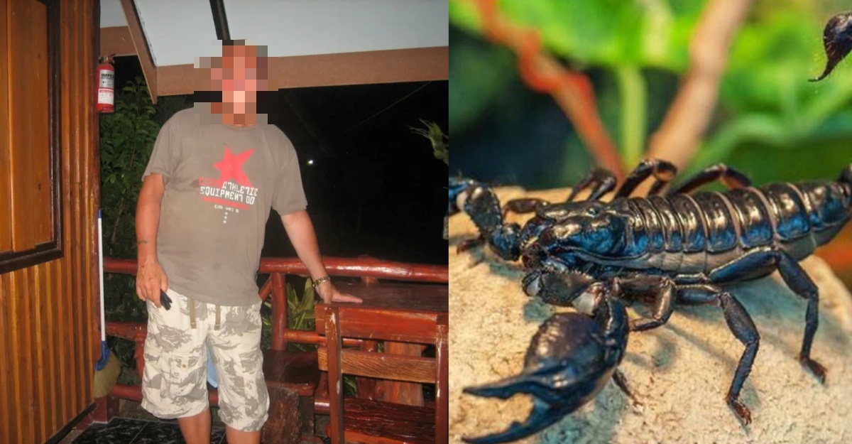 Terpaksa Potong Kaki Lepas Disengat Kala Jengking