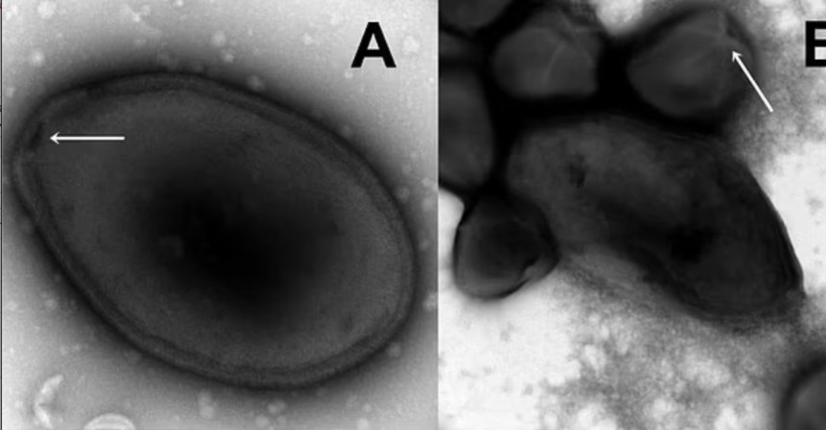 Virus Purba Berusia 48,500 Tahun Dilapor Dihidupkan Semula