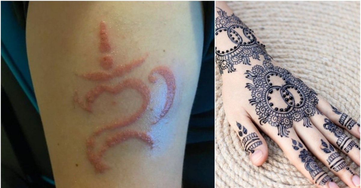 Remaja Terpaksa Tanggung Derita, Henna Hitam Dilukis Di Lengan Bertukar ...