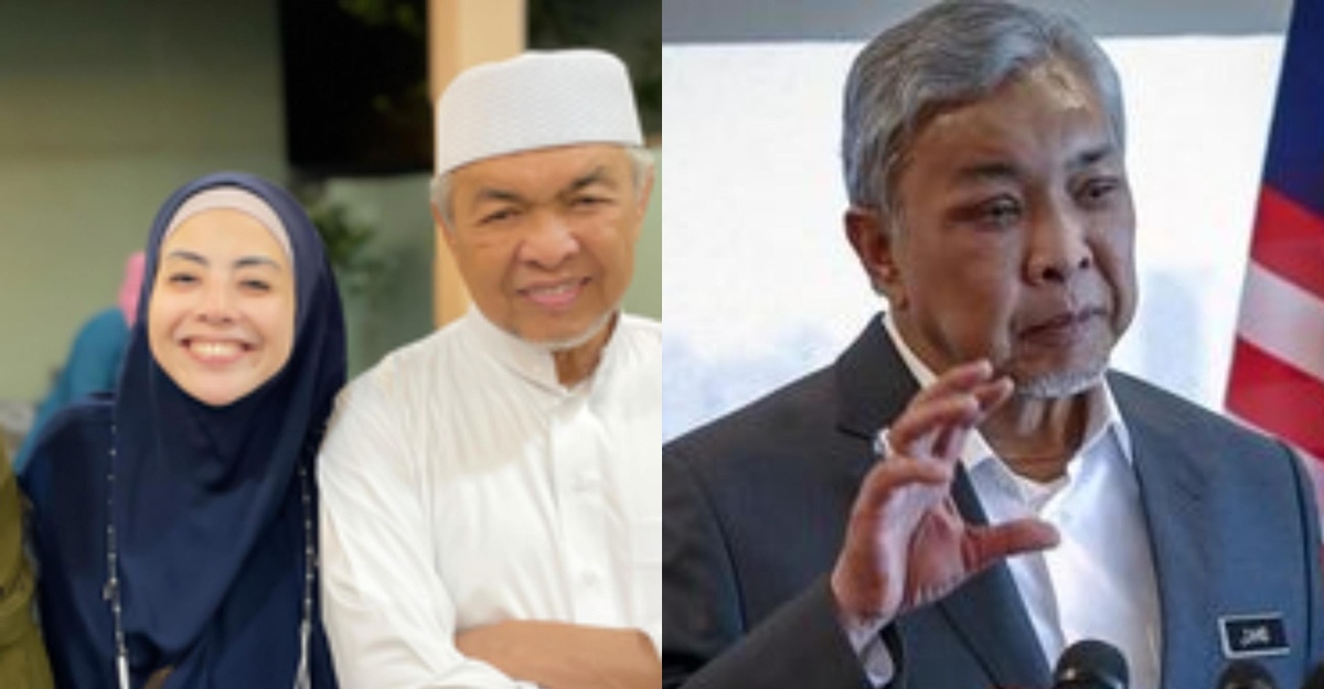 "Saraf Mata Dia Tak Function," Nurul Zahid Dedah Bapa Baru Lepas Jalani Pembedahan Mata