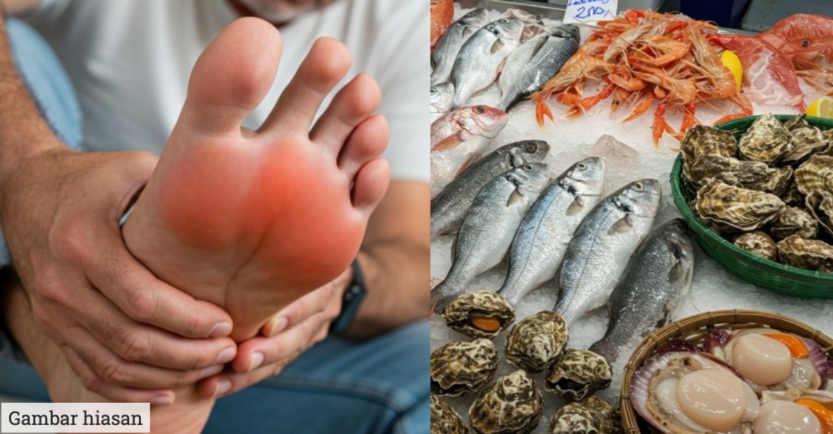 Bukan Lagi Penyakit Orang Tua, Ini Punca Orang Muda Pun Ramai Kena Gout